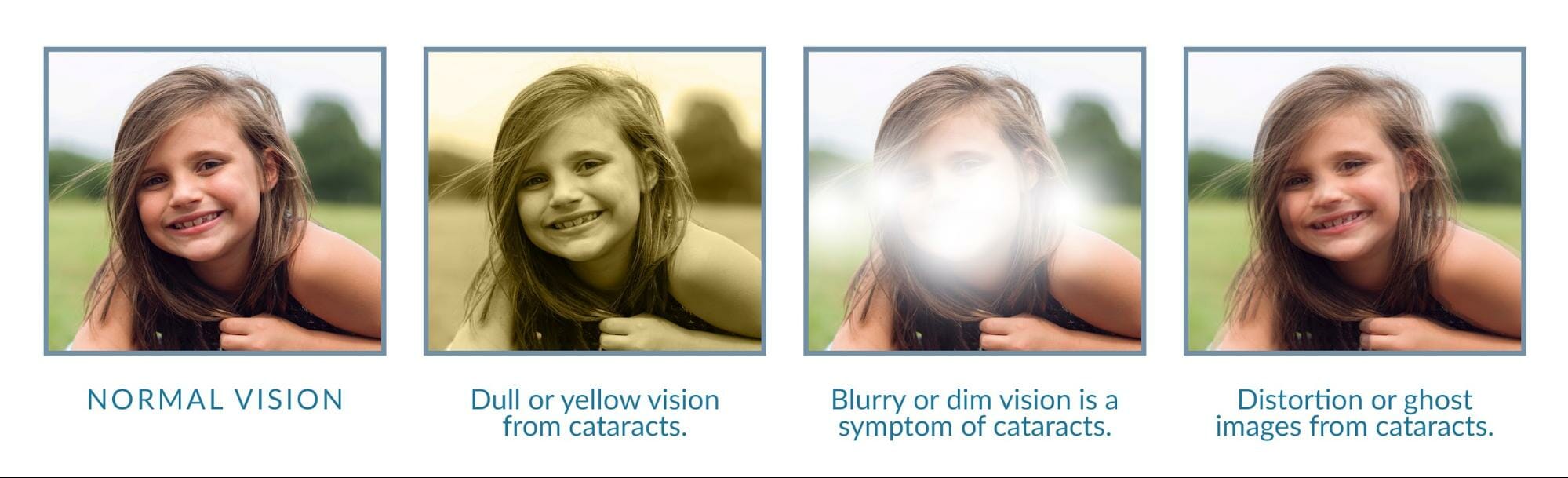 Cataract Causes And Treatment Piedmont Eye Center