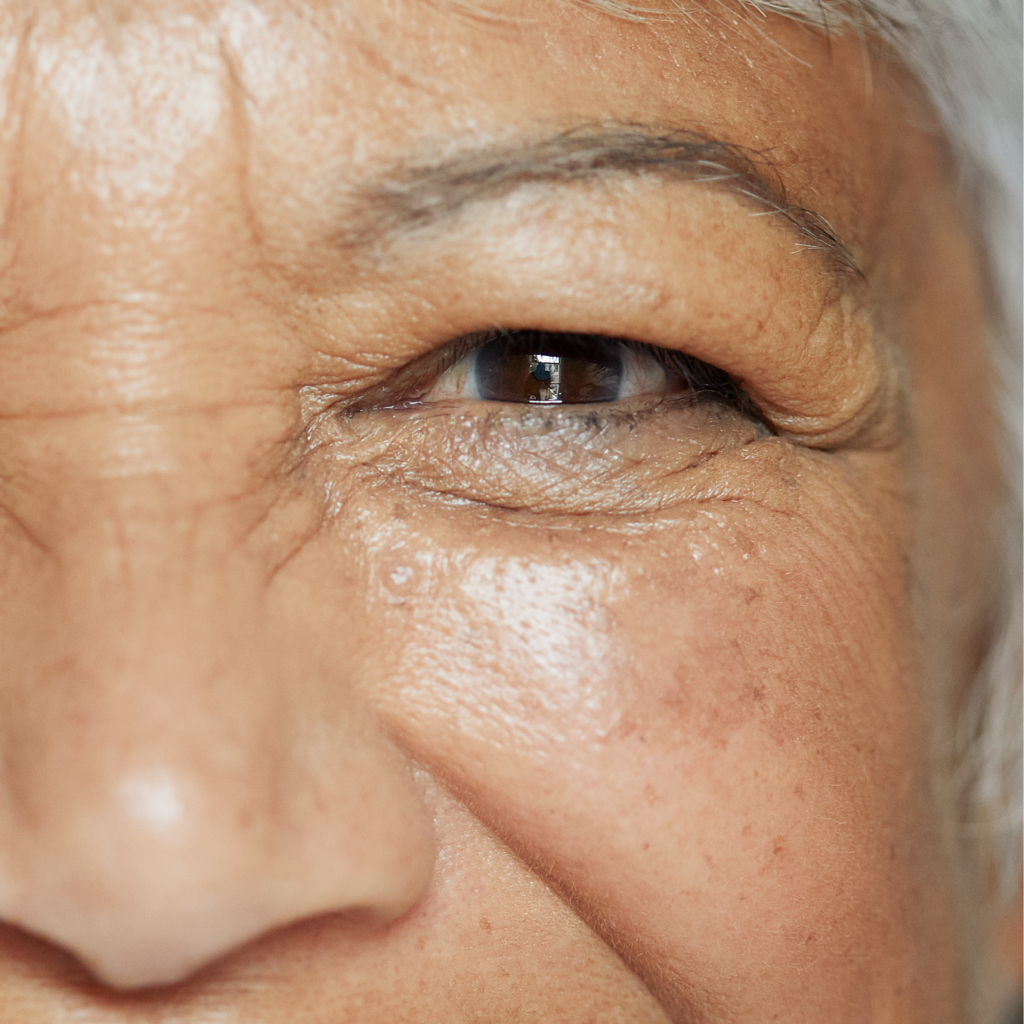 Light Adjustable Lens and Multifocal lenses - Piedmont Eye Center